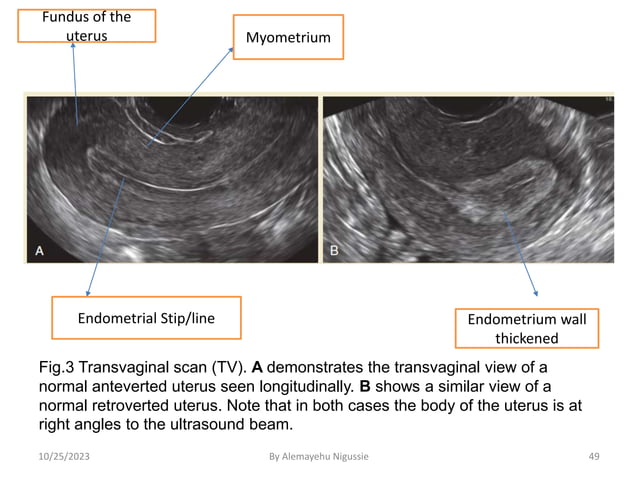 Obstetric Ultrasound final-1.pptx