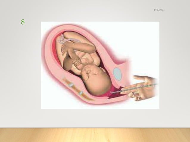 PPT Edukasi Obstetri induksi Persalinan.pptx