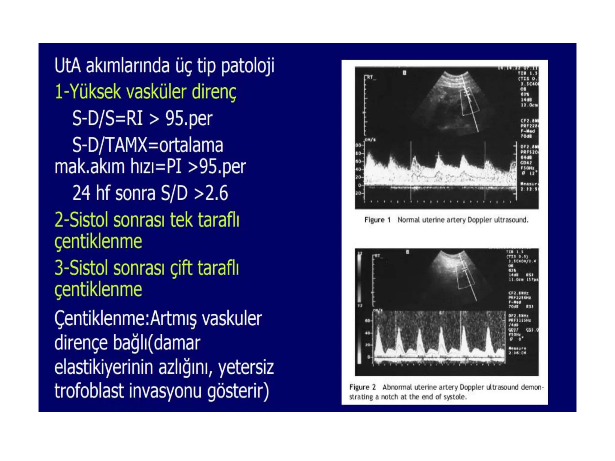 OBSTETRİK DOPPLER ULTRASONOGRAFİ.DR BAHRİ YILDIZ | PPTX