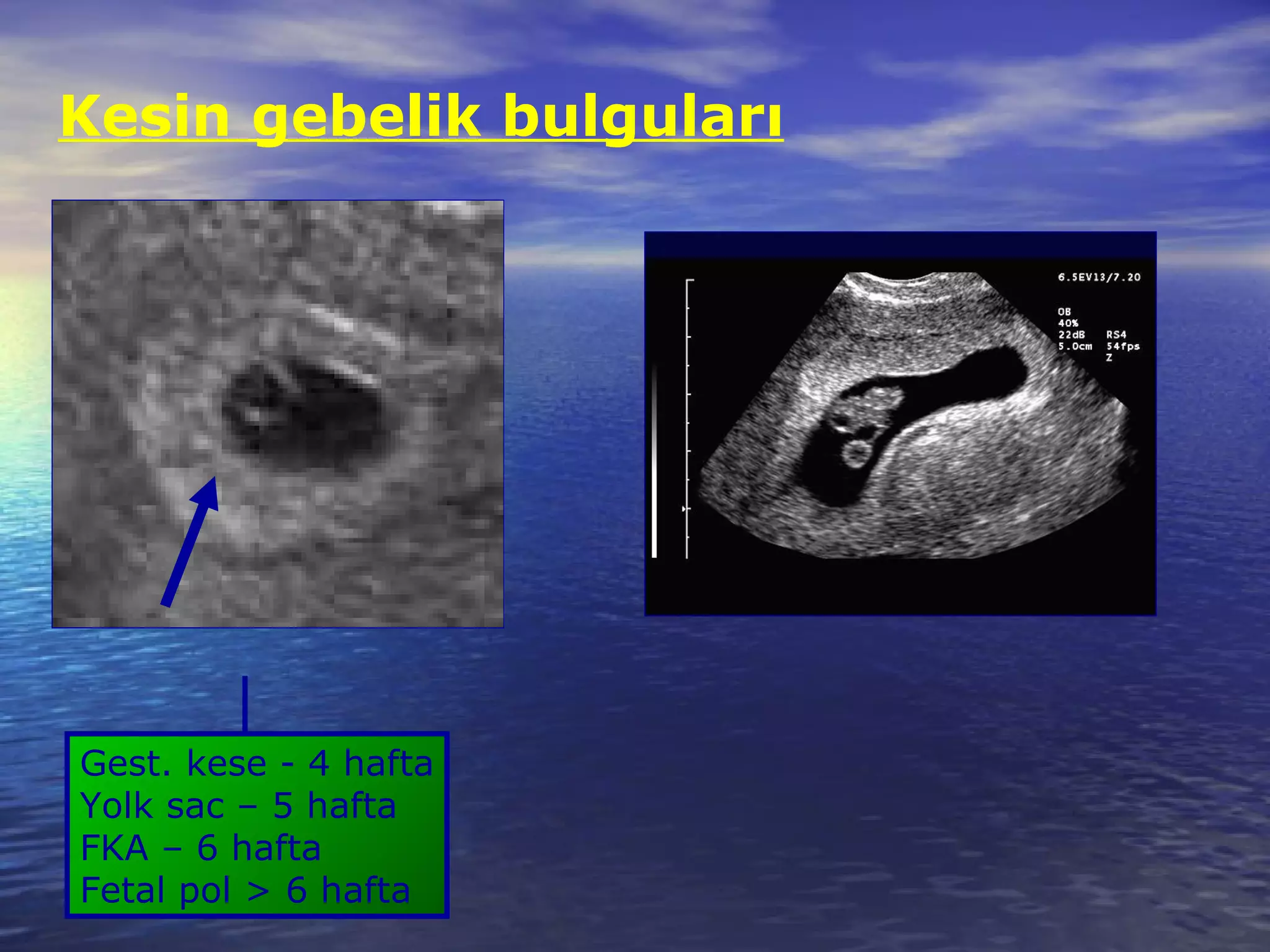 Obstetrik Muayene | PPT