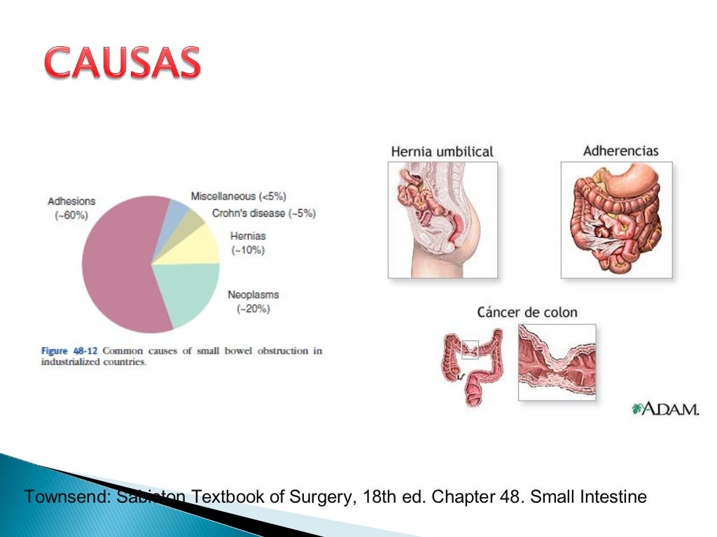 Obstrucción intestinal