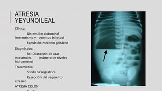 Obstrucción intestinal | PPTX
