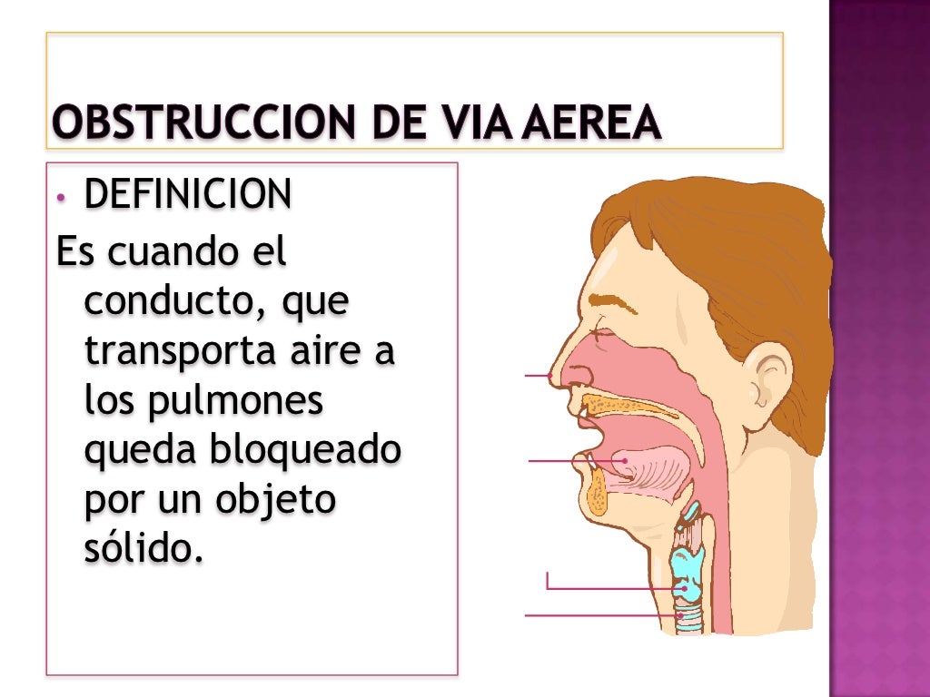 ObstruccióN Via Aerea