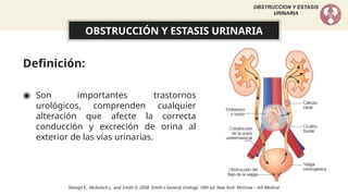 Obstrucción y Estasis Urinaria Seminario.pptx