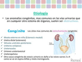 Obstrucción y Estasis urinarias (1) | PPTX