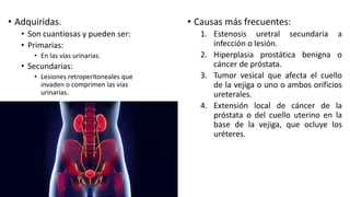 Obstrucción y estasis urinaria | PPTX