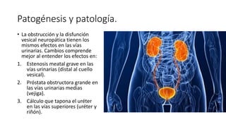 Obstrucción y estasis urinaria | PPTX