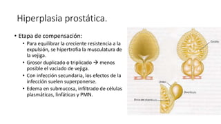 Obstrucción y estasis urinaria | PPTX