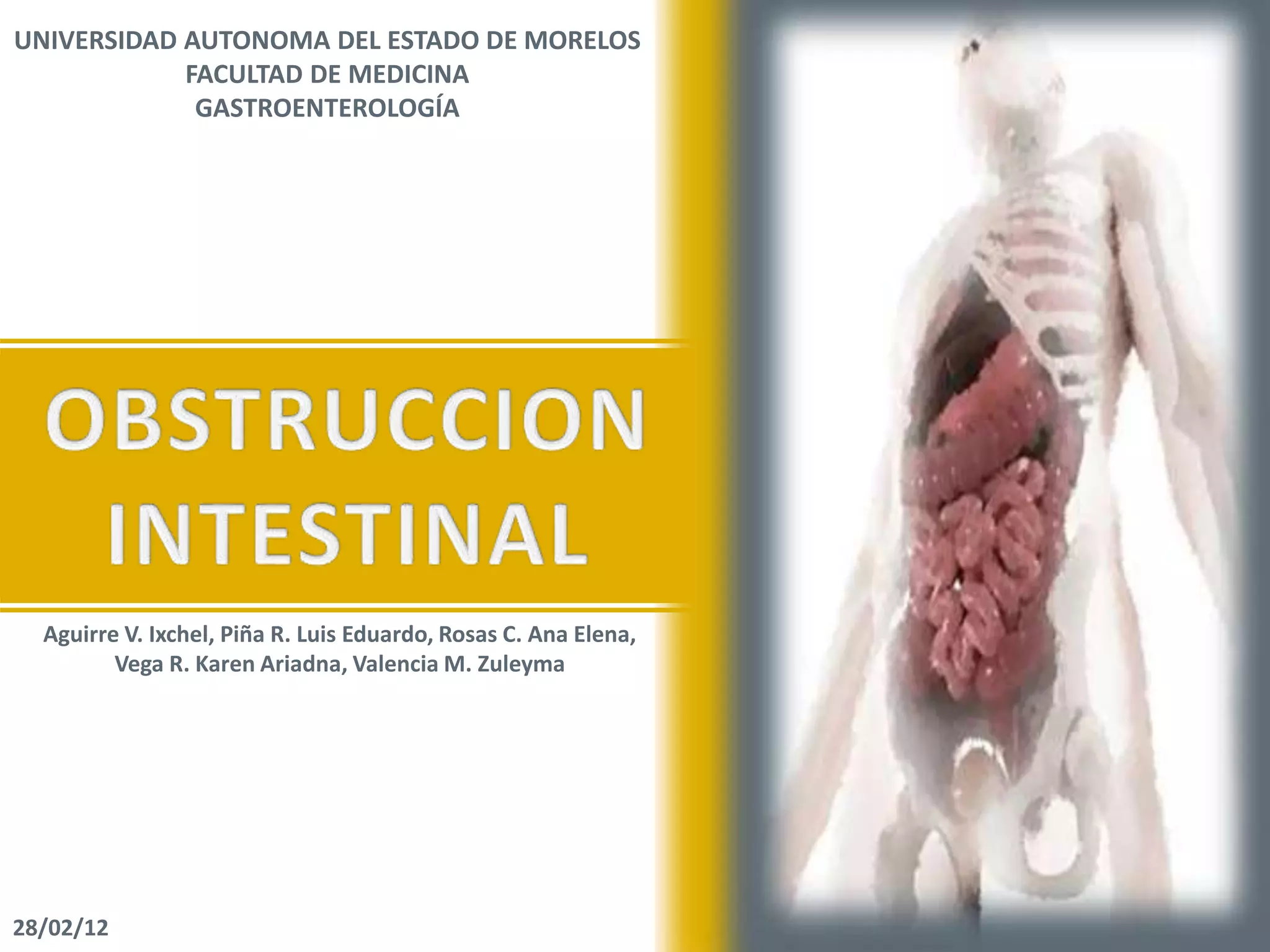 Obstruccion intestinal | PPTX