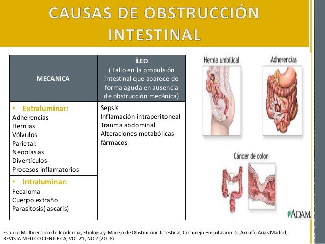 Obstruccion intestinal