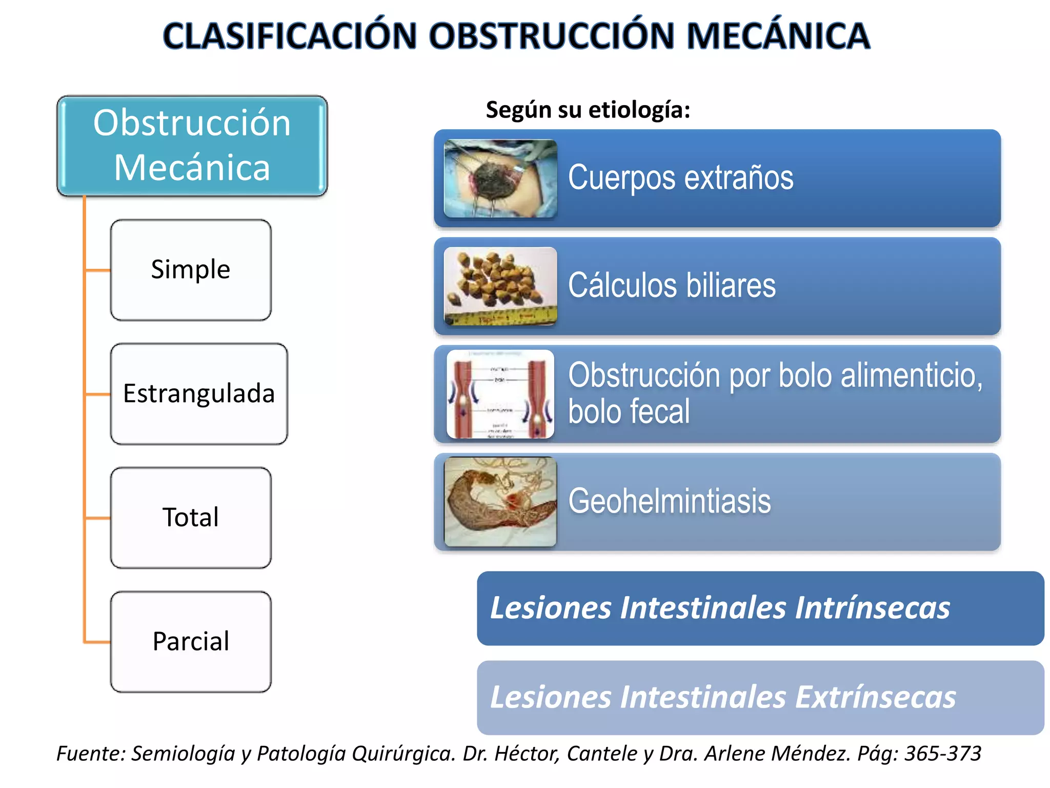 Obstrucción intestinal cirugia | PPT