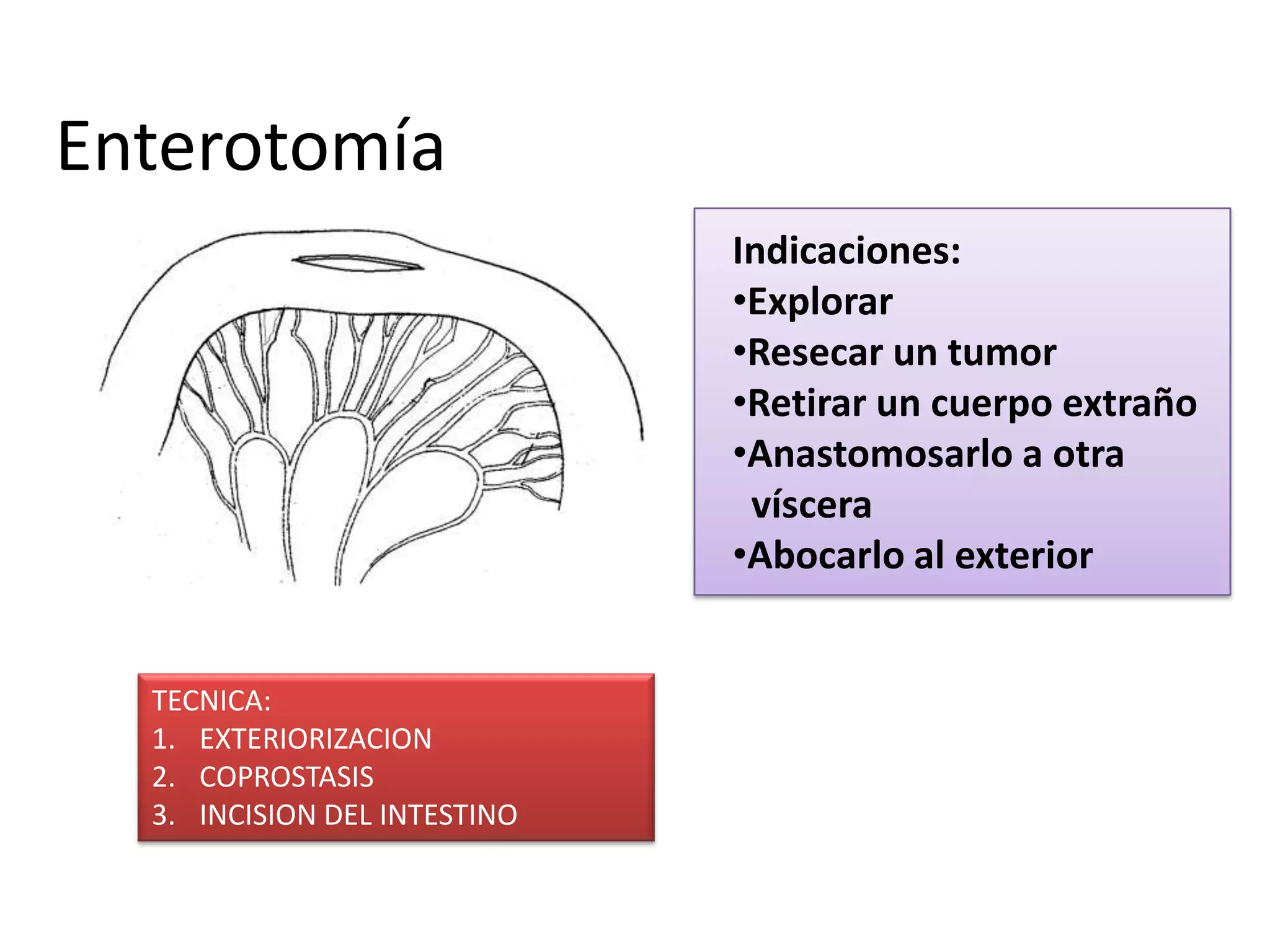 Obstruccion intestinal | PPT
