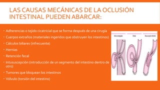 Obstruccion intestinal | PPTX