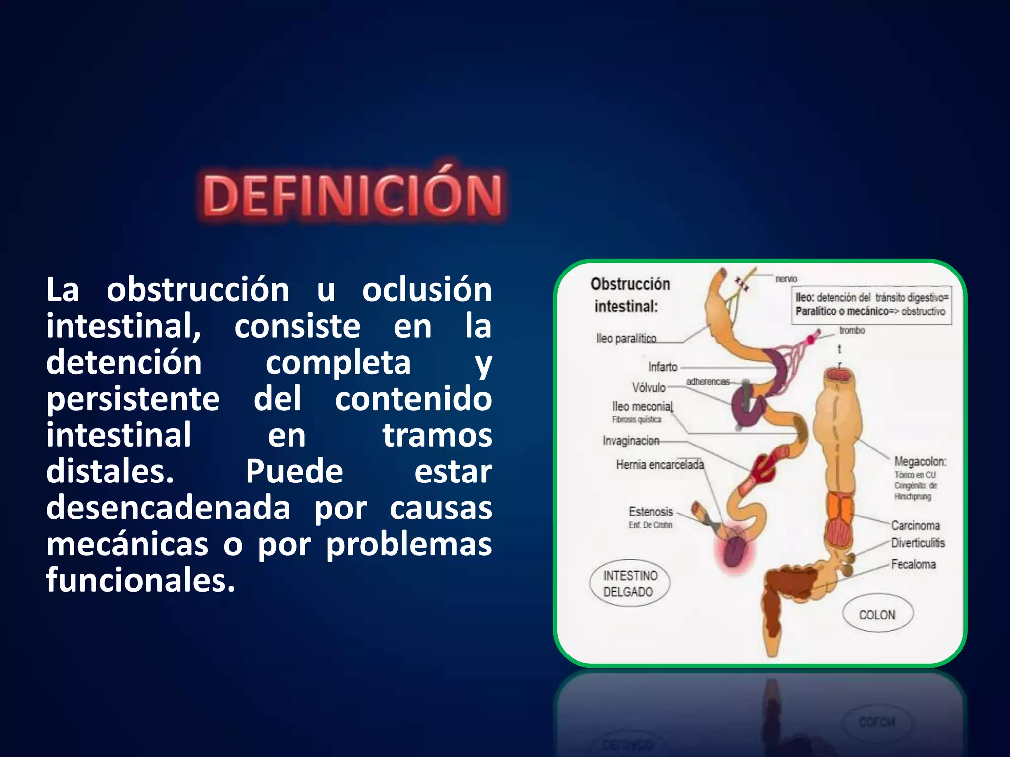 Obstruccion intestinal | PPTX