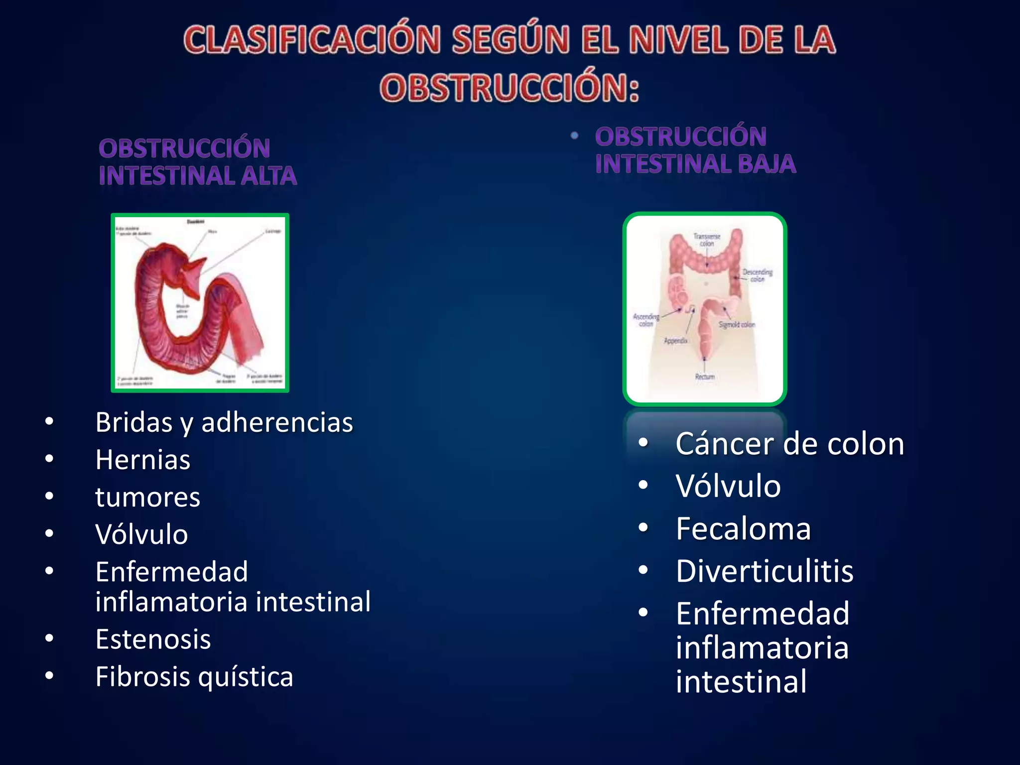 Obstruccion intestinal | PPTX