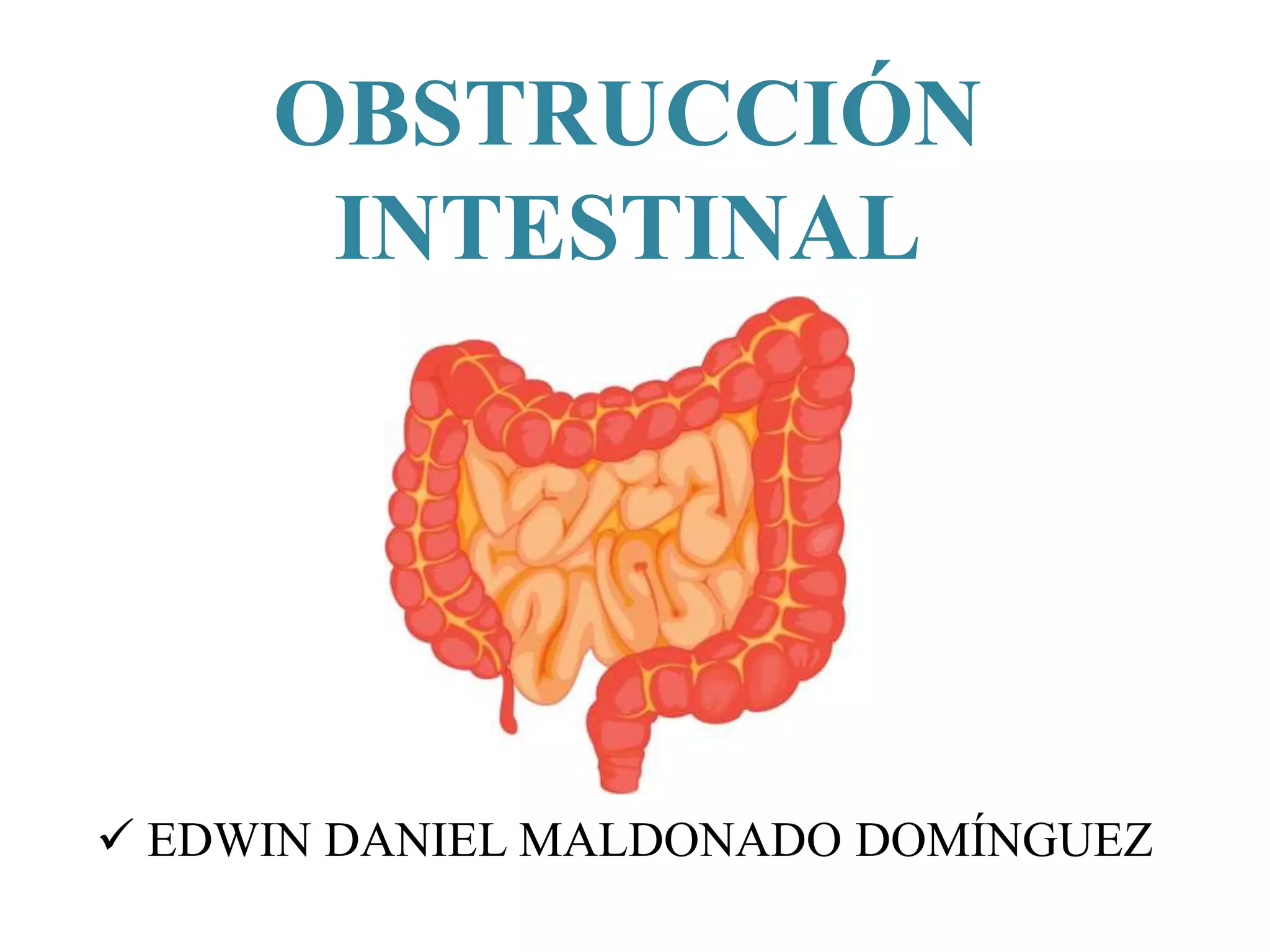 Obstruccion Intestinal | PPTX