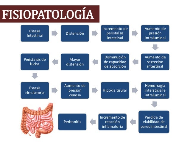 Obstruccion Intestinal