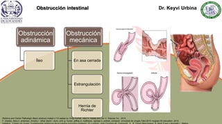 obstruccion intestinal, clasificacion.pptx