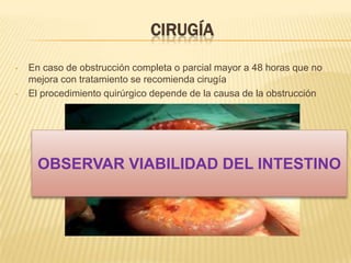 Obstruccion intestinal (1) | PPT