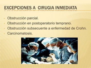 Obstruccion intestinal (1) | PPT