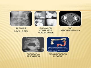 Obstruccion intestinal (1) | PPT