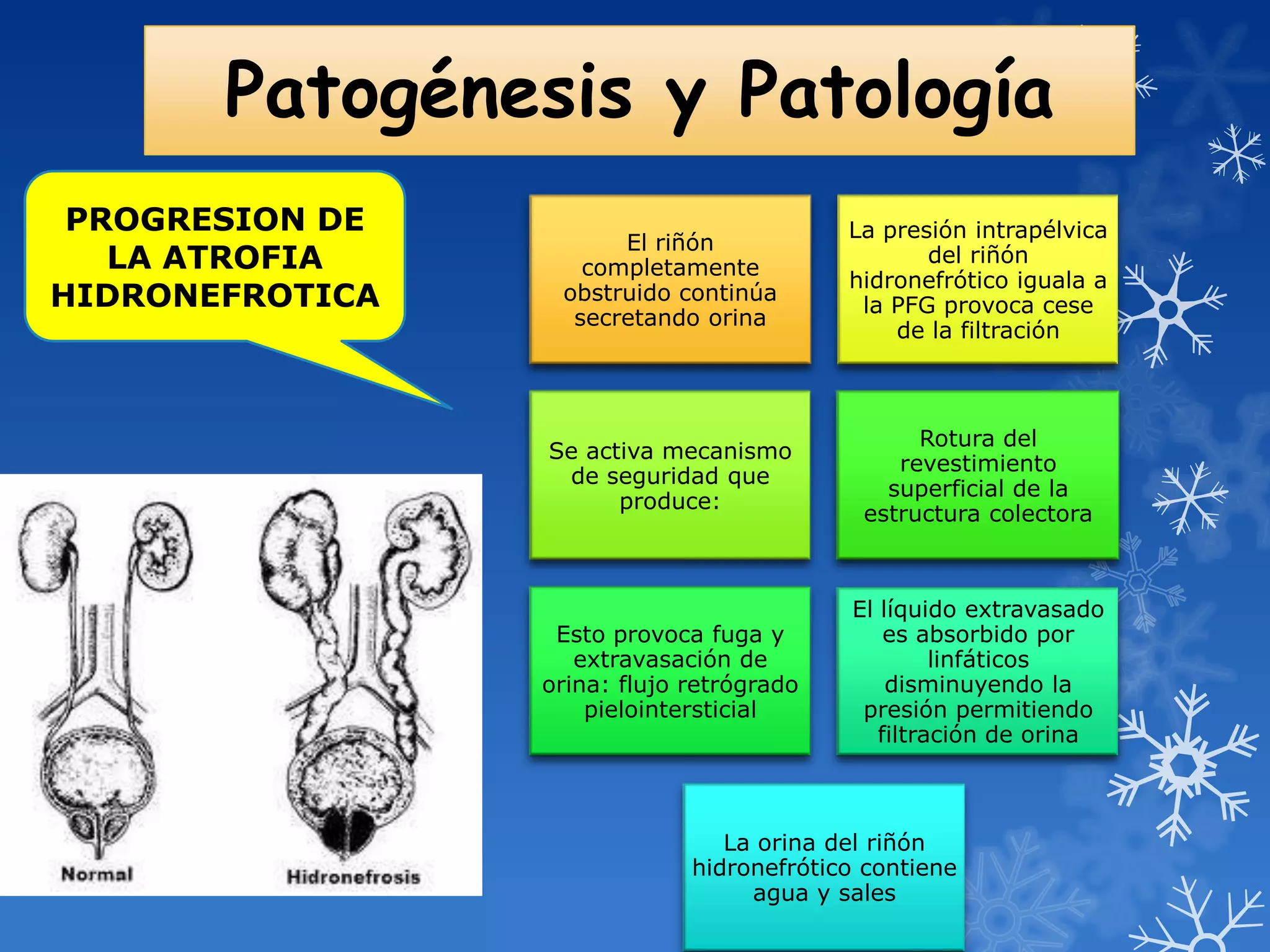 Obstruccion y estasis urinaria | PPTX