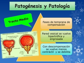 Obstruccion y estasis urinaria | PPTX