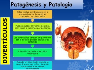 Obstruccion y estasis urinaria | PPTX