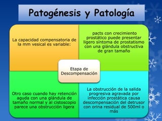 Obstruccion y estasis urinaria | PPTX