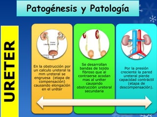 Obstruccion y estasis urinaria | PPTX
