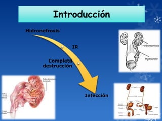 Obstruccion y estasis urinaria | PPTX
