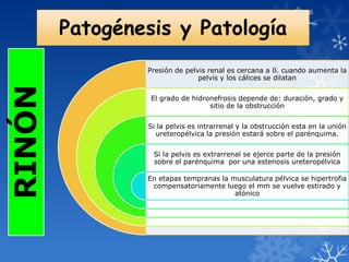 Obstruccion y estasis urinaria | PPTX