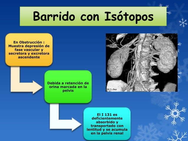 Obstruccion y estasis urinaria | PPTX