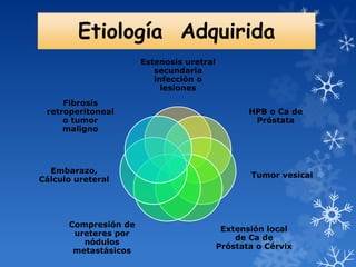 Obstruccion y estasis urinaria | PPTX