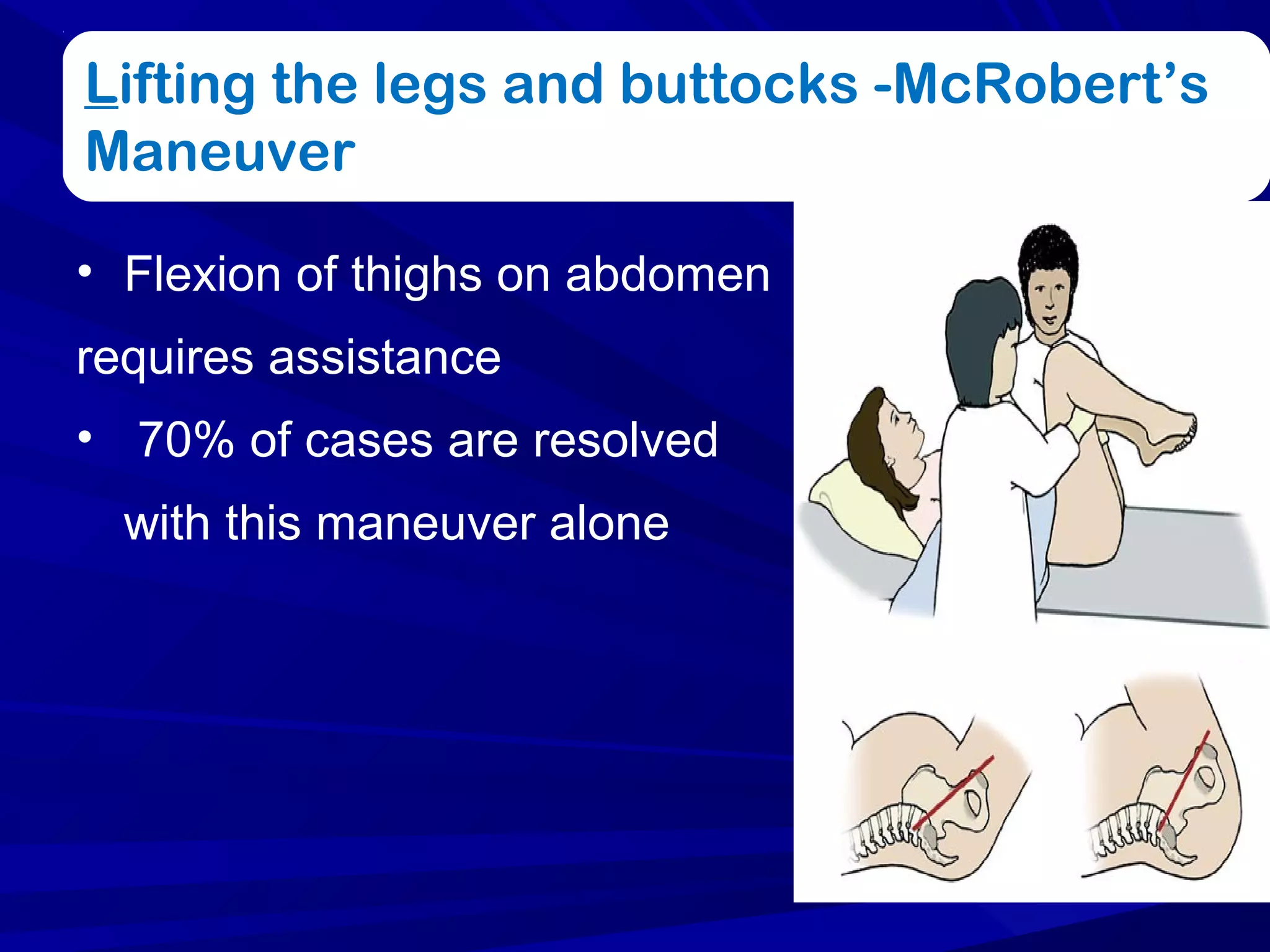 Obstructed labor and shoulder dystocia for undergraduate | PPT