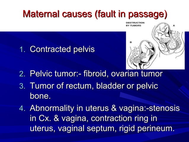 Obstructed labor and shoulder dystocia for undergraduate | PPT ...