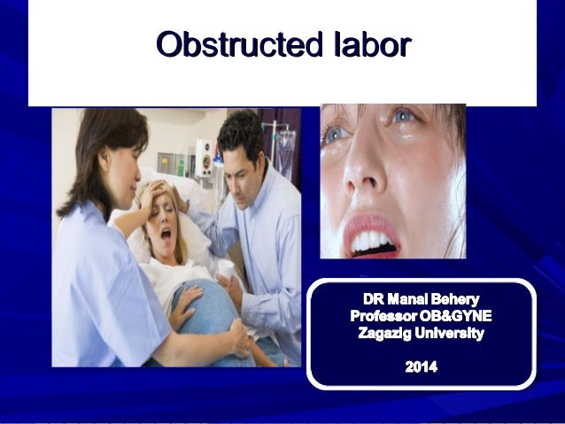Obstructed labor and shoulder dystocia for undergraduate