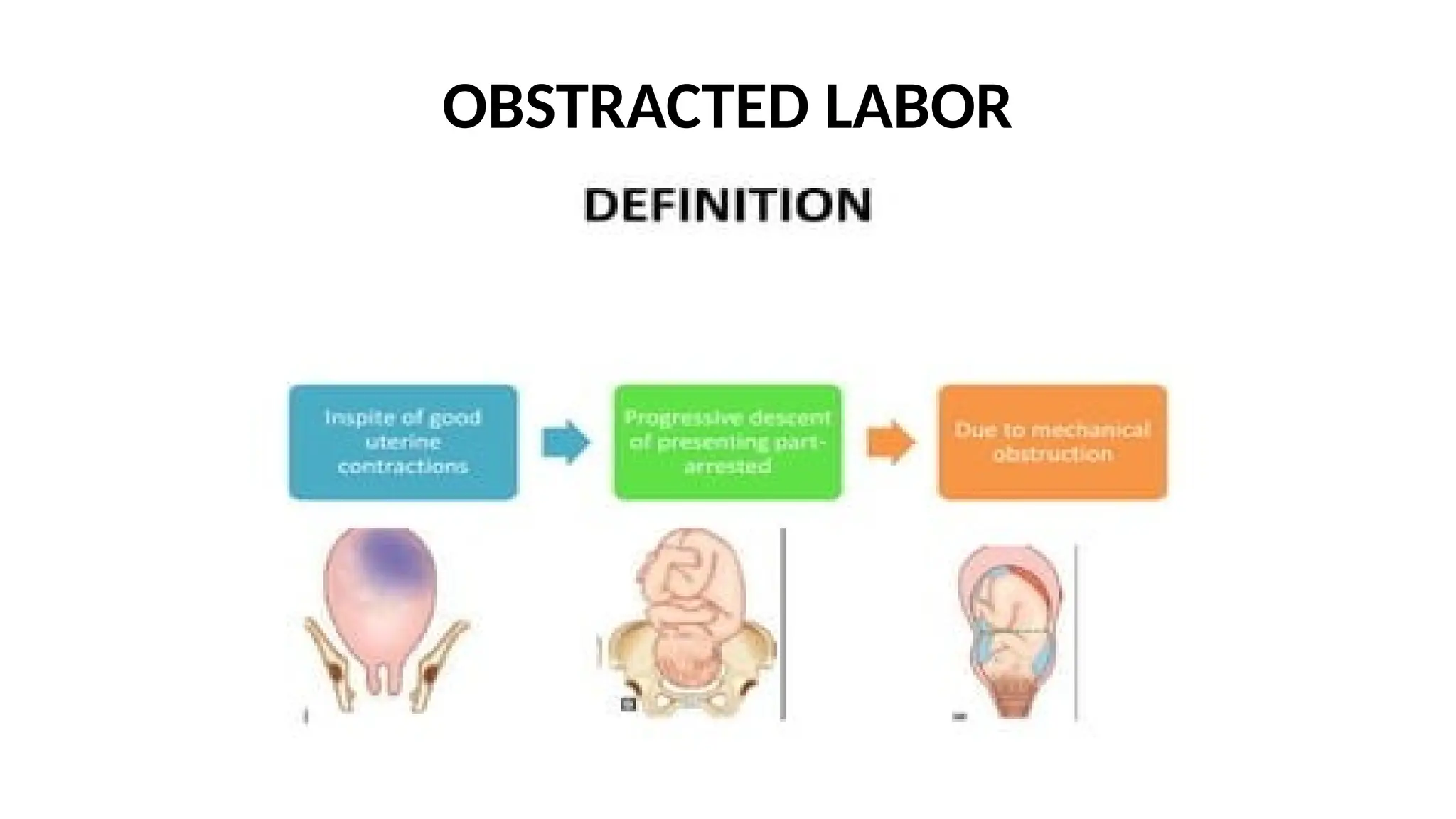 OBSTRUCTED LABOUR, MAL POSITION AND MAL PRESENTATION.pptx