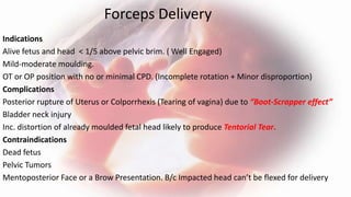 Obstructed labor management | PPTX