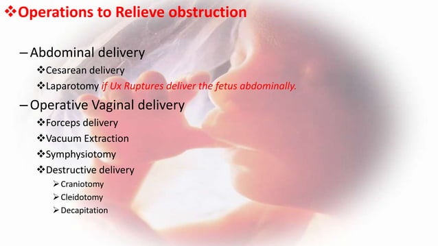 Obstructed labor management | PPTX