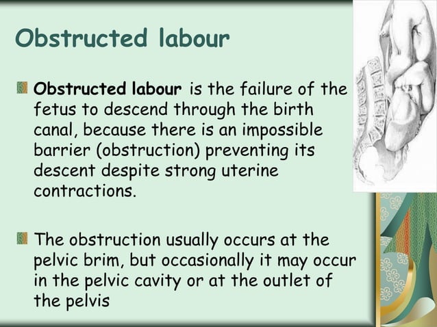 Obstructed labor | PPTX