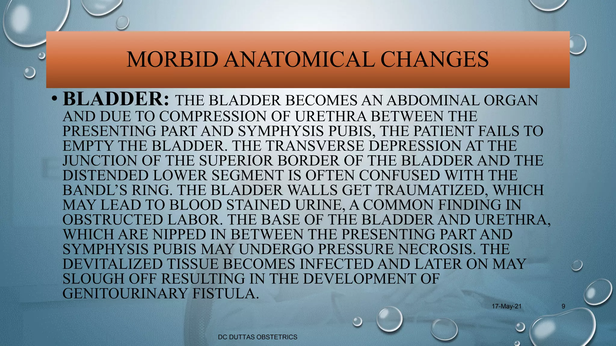 OBSTRUCTED LABOUR -EBM.pdf