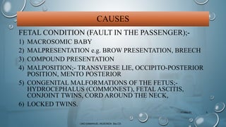 OBSTRUCTED LABOUR -EBM.pdf