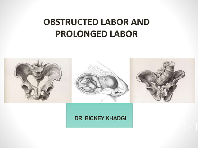 Obstructed labour and Prolonged Labour | PPTX