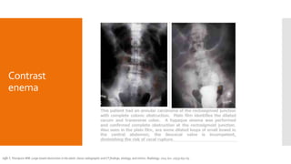 Obstructed recto sigmoid malignancy | PPT