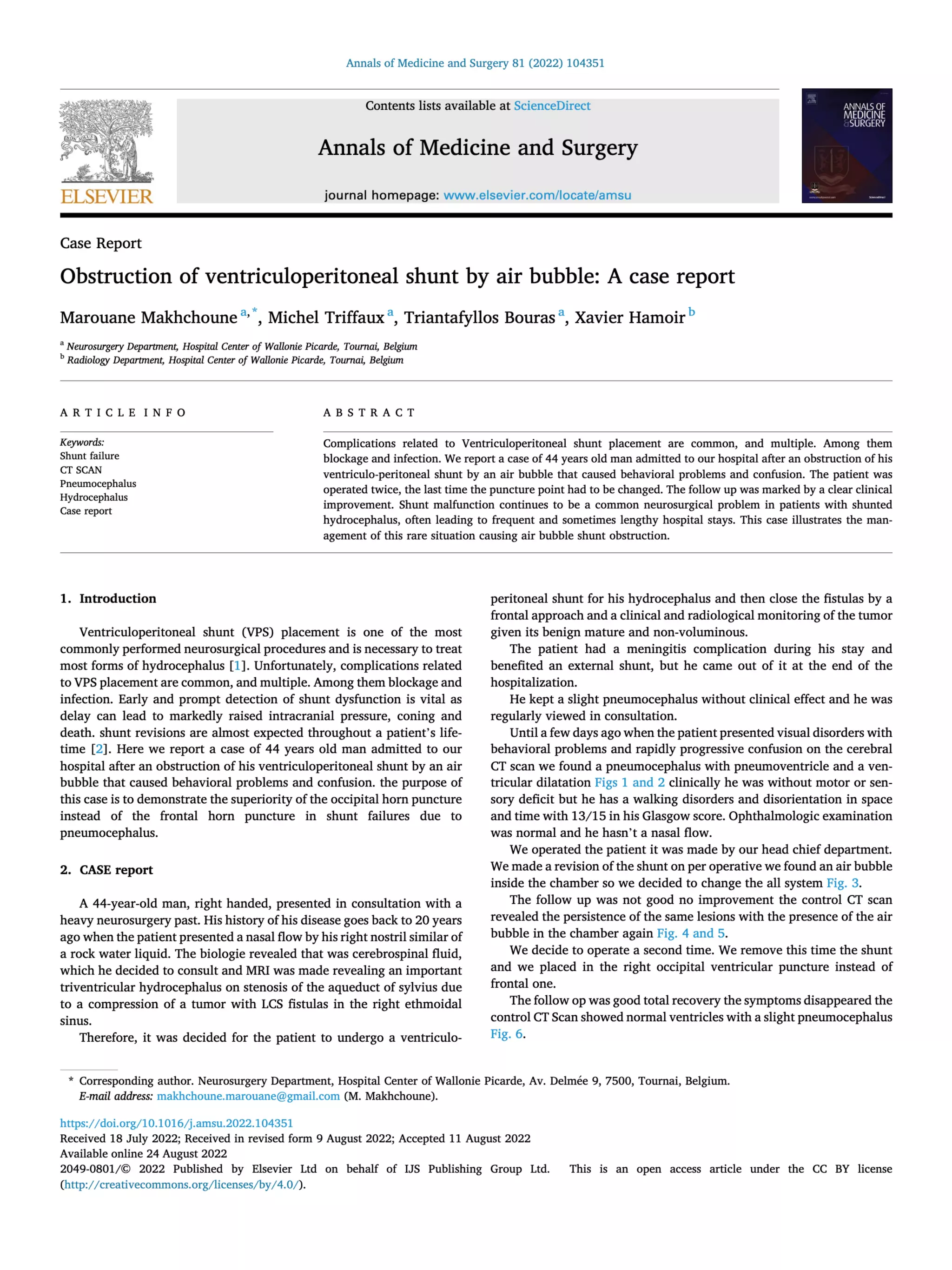 Obstruction of ventriculoperitoneal shunt by air bubble | PDF