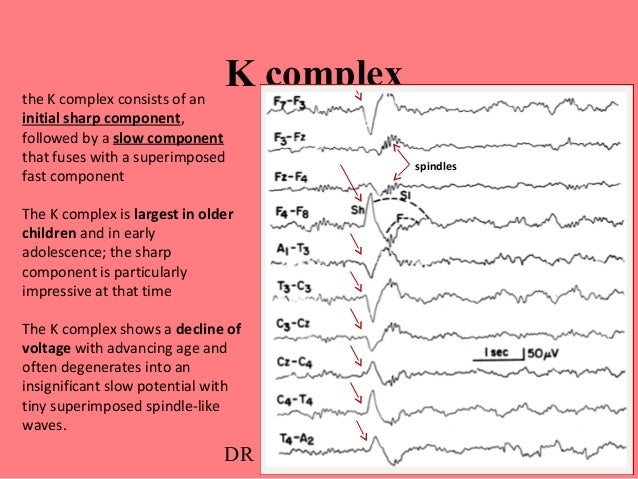 Obstructive sleep apnea and snoring (OSA)