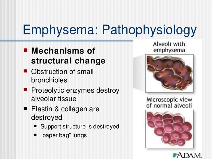 Obstructive And Inflammatory Lung Disease