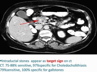 Approach to a case of Obstructive jaundice | PPTX