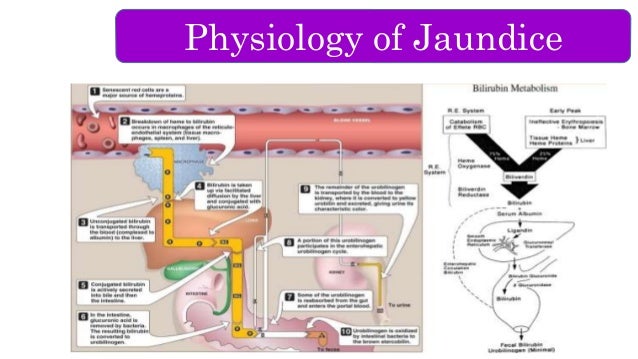 Obstructive jaundice- Introduction